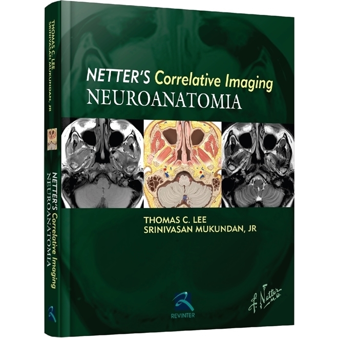 Neuroanatomia - Netter’s Correlative Imaging