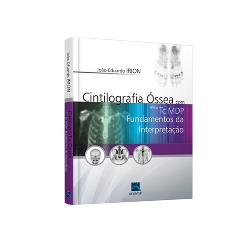 CINTILOGRAFIA ÓSSEA COM 99M TC MDP - FUNDAMENTOS DA INTERPRETAÇÃO