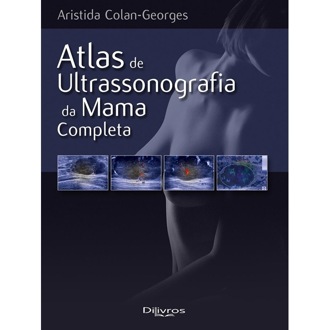 Atlas de Ultrassonografia da Mama Completa