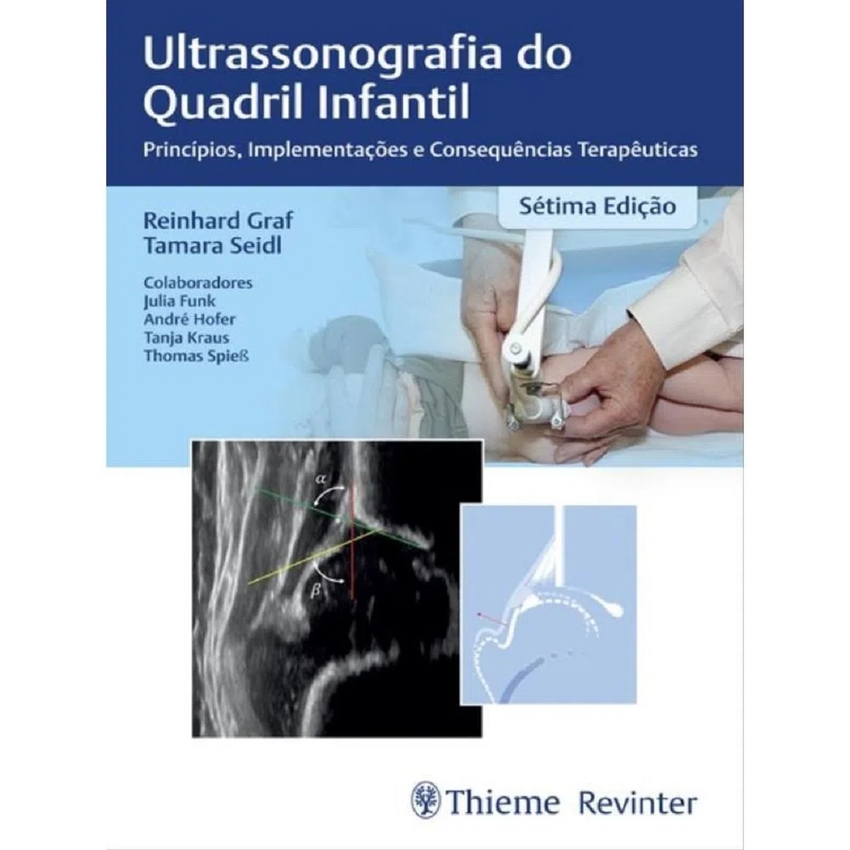 Ultrassonografia do Quadril Infantil: Principios, Implementações e ...